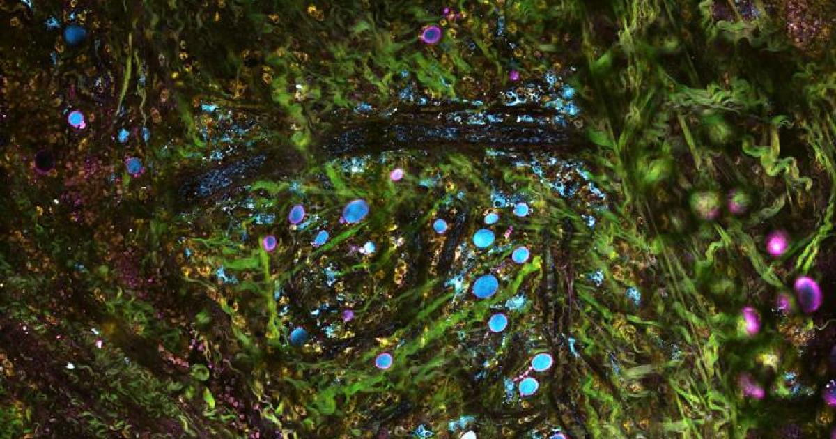 New microscope system may image cancer progression, tumorous cells in ...
