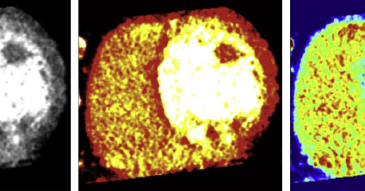 Does display color scale affect diagnostic imaging performance?