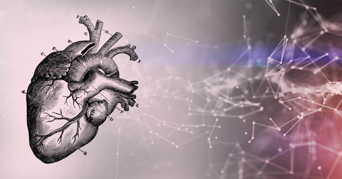 Machine learning screens for obstructive CAD, reduces unnecessary imaging