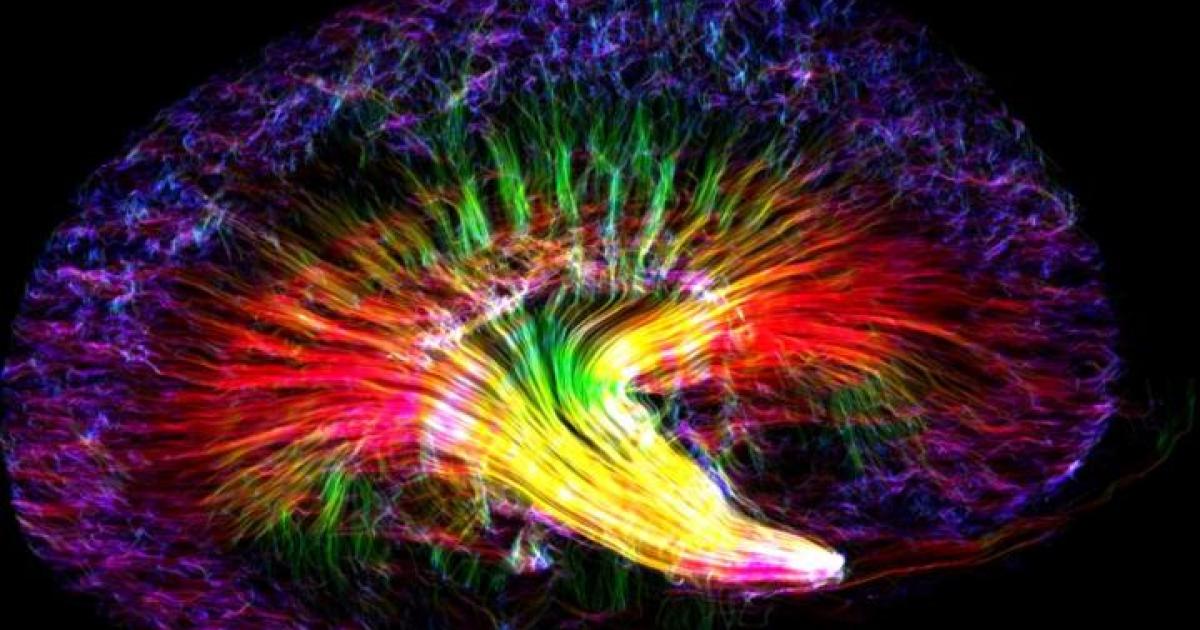 MRI scan using diffusion tensor imaging wins photo competition