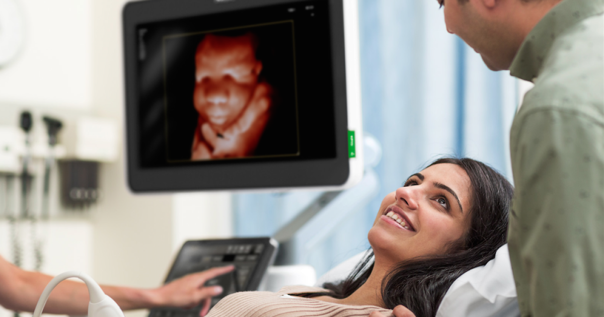 Philips expands portfolio with EPIQ Elite premium ultrasound system for General Imaging and ...
