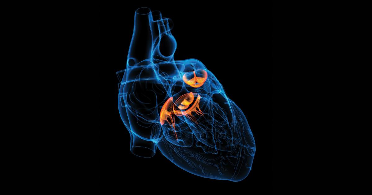 FDA approves first AI-assisted cardiac MRI scanner