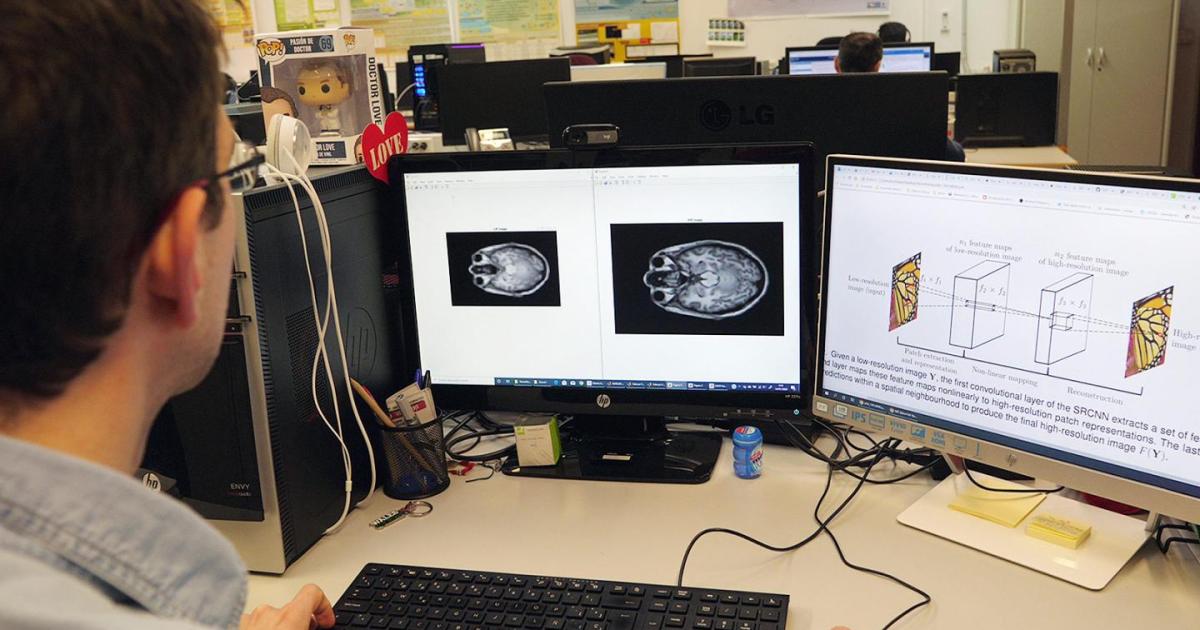 AI turns low-quality brain scans into ‘super resolution’ MRIs