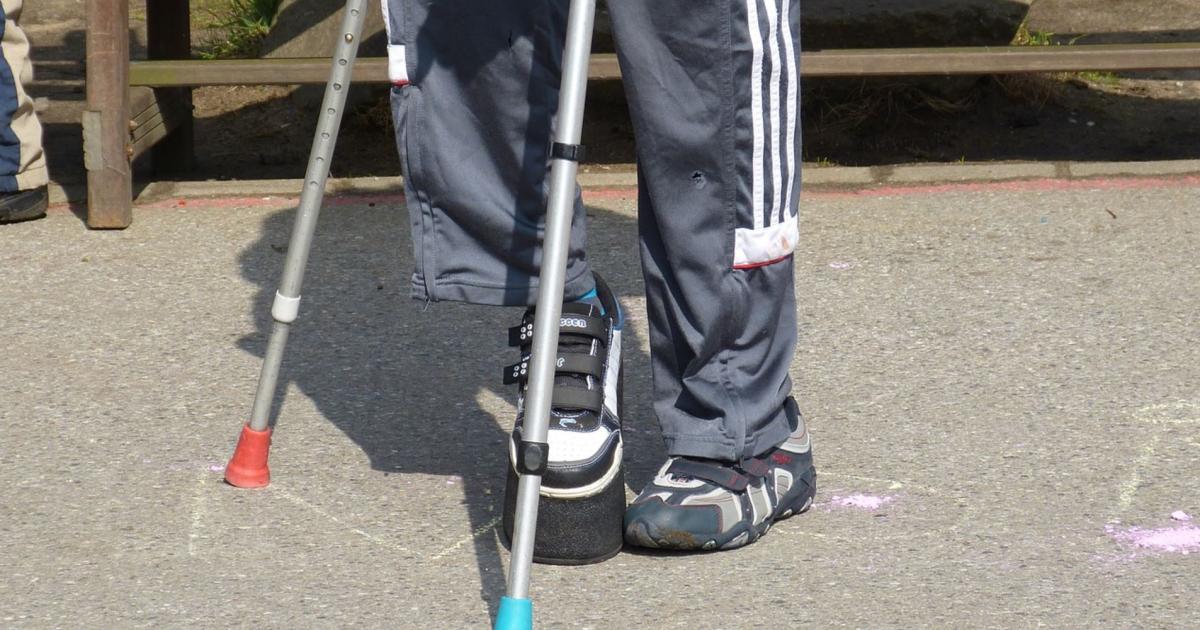 Algorithm measures children’s leg-length discrepancies in 1 second