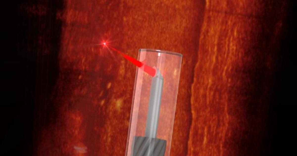 ‘World’s smallest’ imaging device has large implications for cardio care