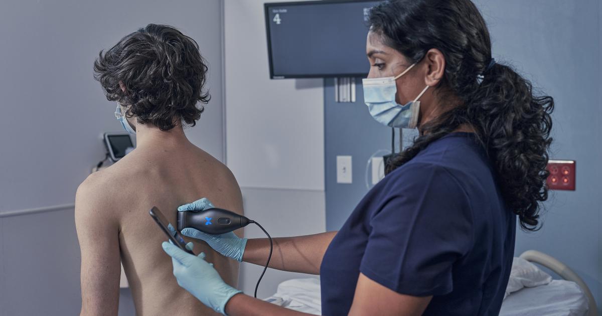 FDA clears new point-of-care ultrasound system from Butterfly Network