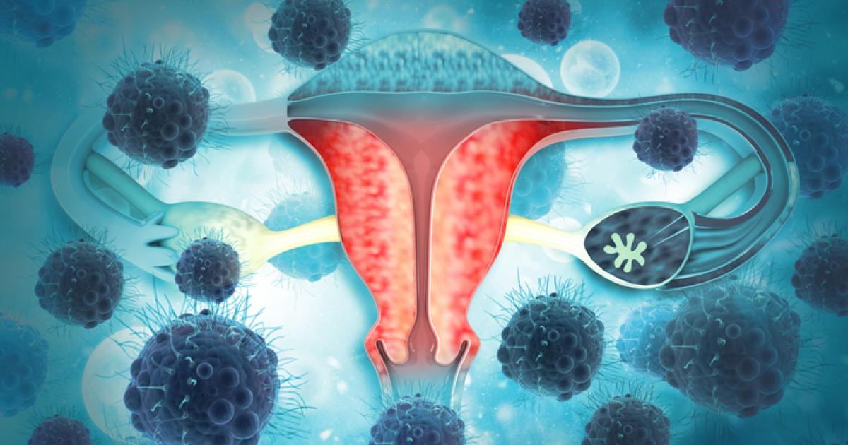 Lab receives $30M funding to illuminate lung and ovarian cancers