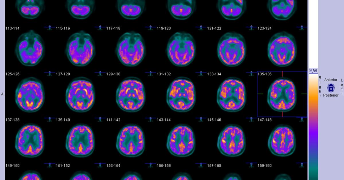GE Healthcare doubling distribution of imaging tracer to meet expected ...