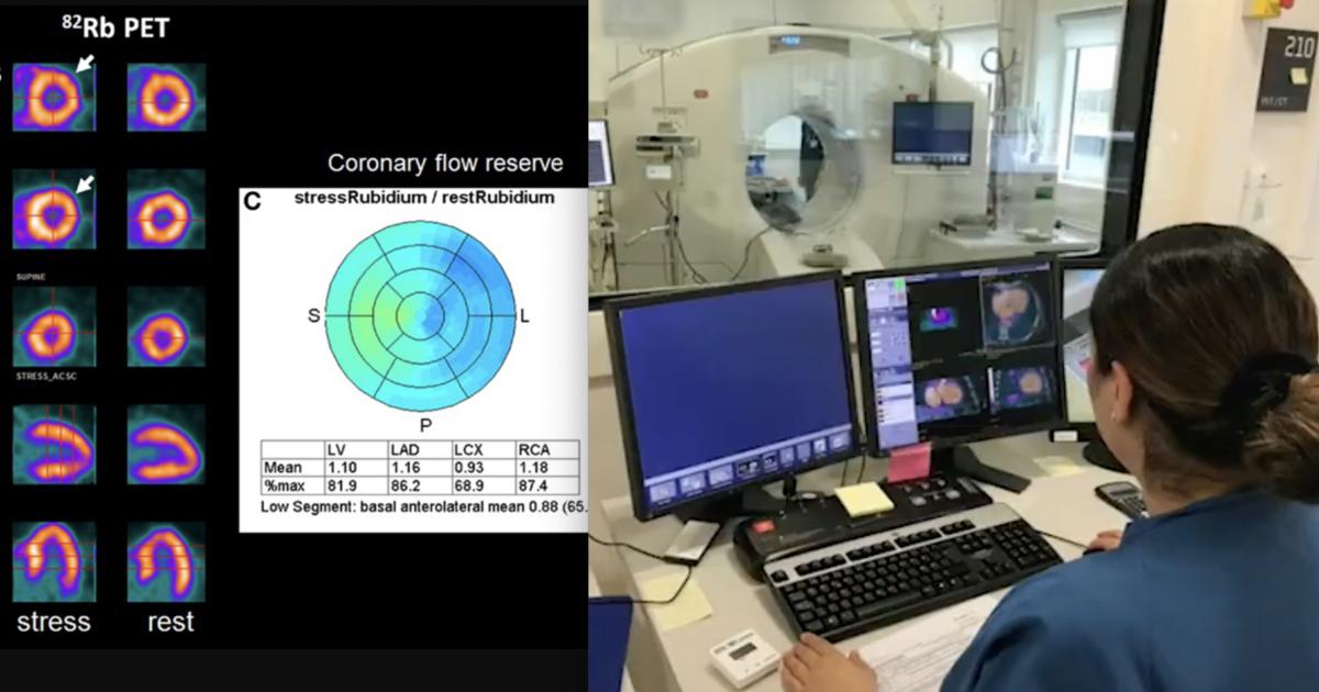 Nuclear Cardiology Nuclear Cardiology ScienceDirect