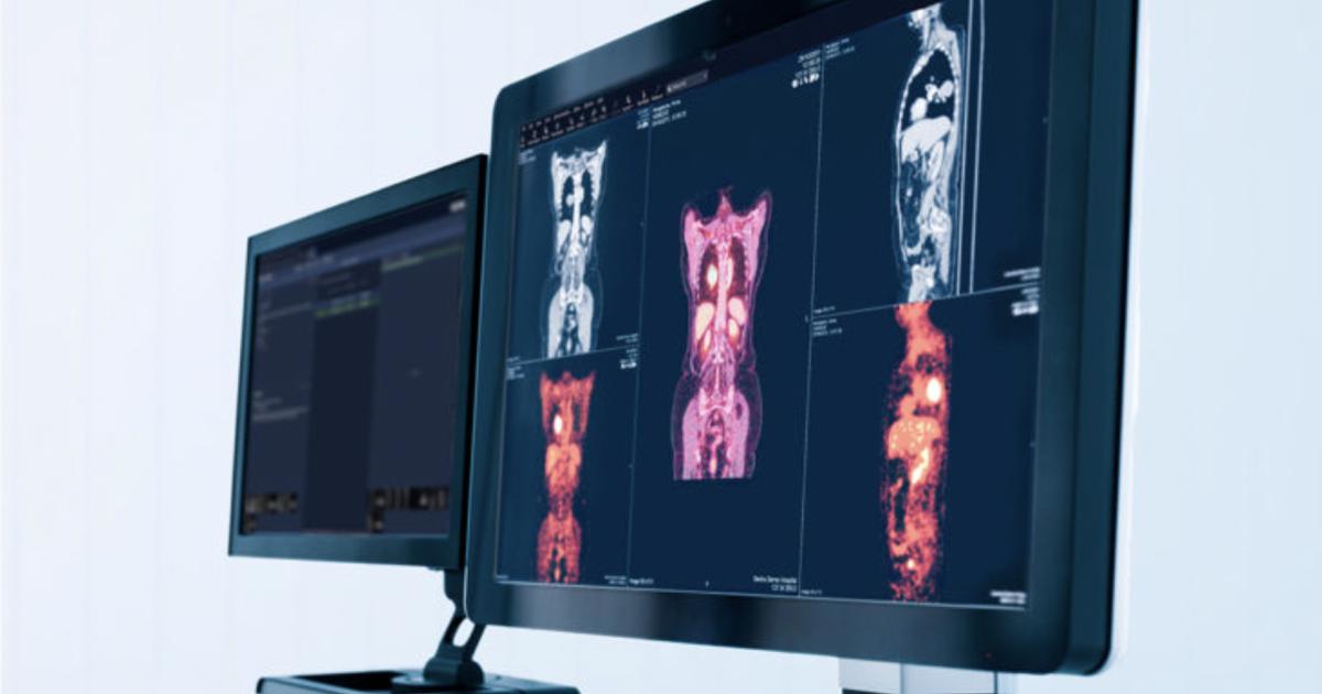 VIDEO: How to Prevent Radiologist Burnout