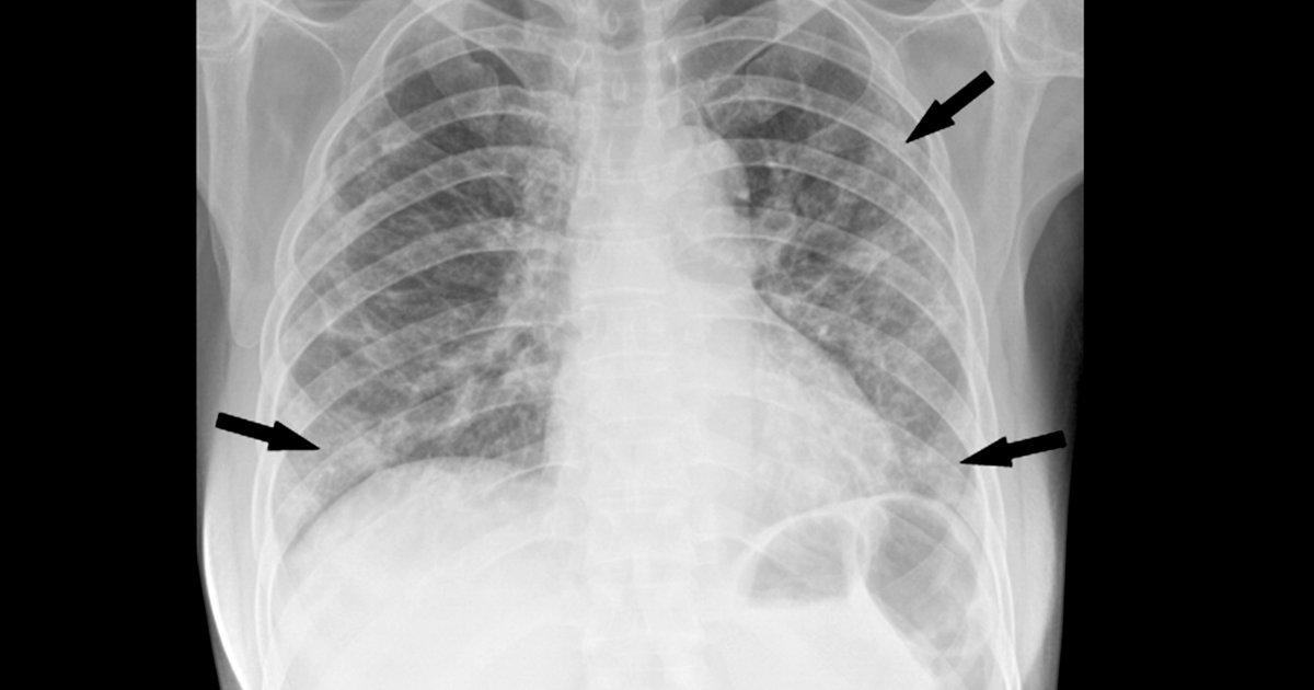 Current imaging AI systems can be repurposed to address future ...