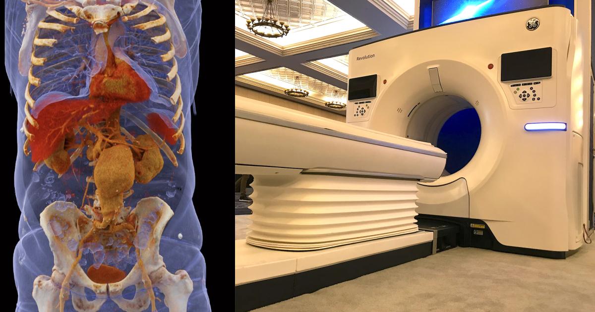 VIDEO: CT imaging market trends and advances overview by Signify Research