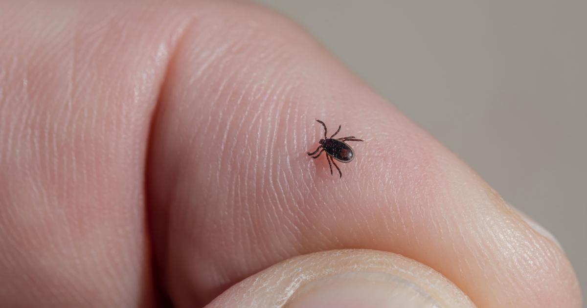 Lyme disease neuroimaging uncovers compensatory brain repair