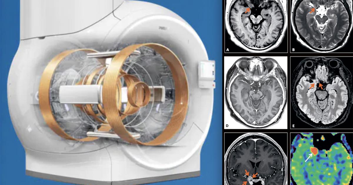VIDEO: Overview of MRI market and technology trends
