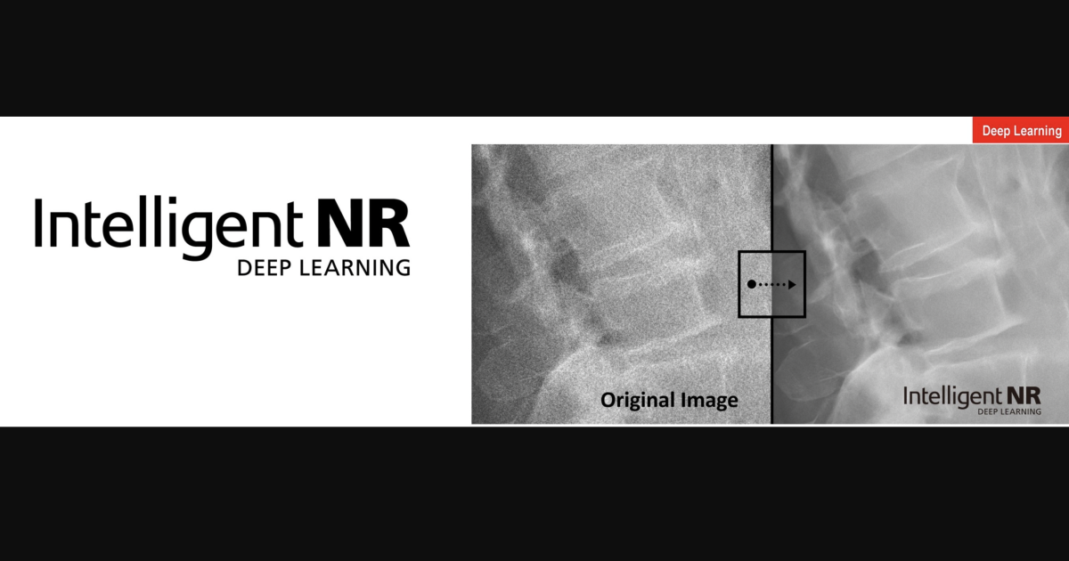 Canon Medical Components U.S.A., Inc. announces launch of new products ...