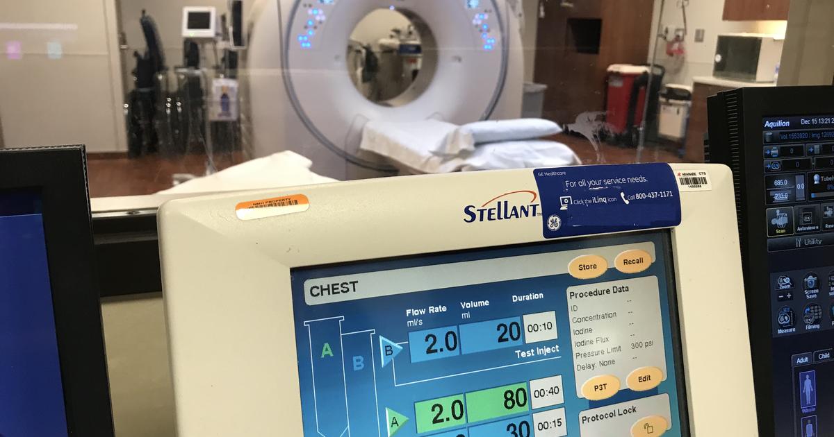 Test bolus of diluted contrast optimizes scan timing during CTA