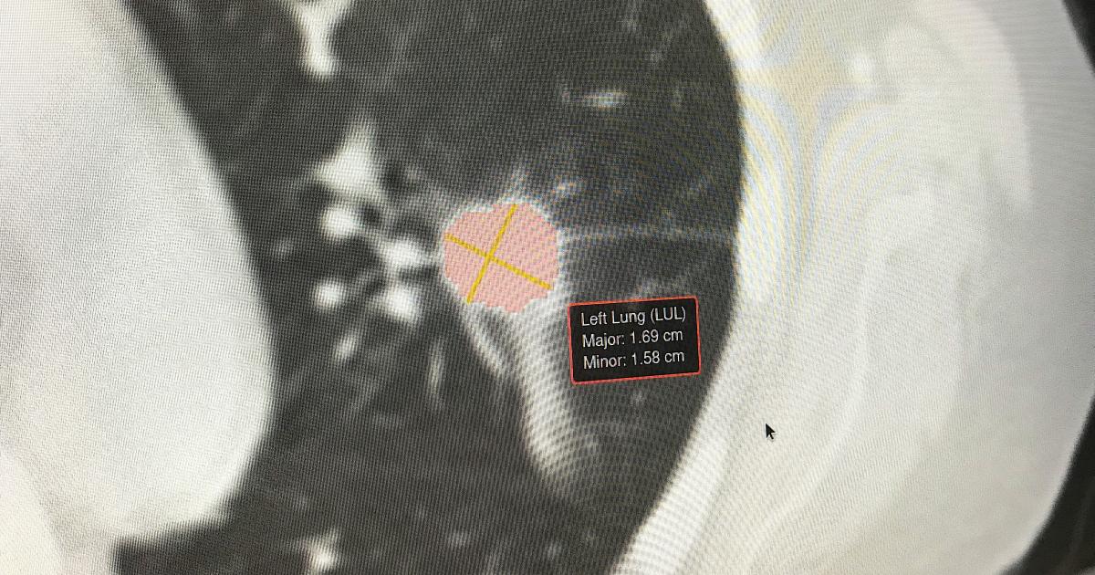 8 trends in radiology technology to watch in 2023