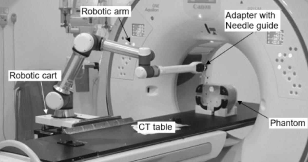 Robot-assisted needle positioning in CT-guided procedures improves ...