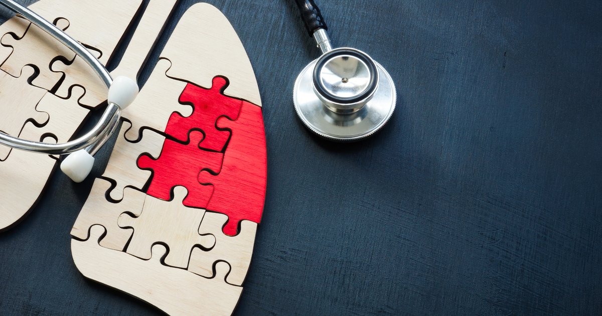 How one hospital more than doubled its lung cancer screening rate