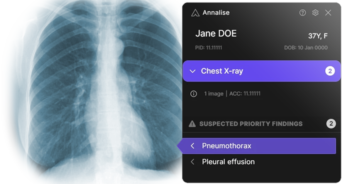 AI-powered radiology triage tech prioritizes image review based on ...