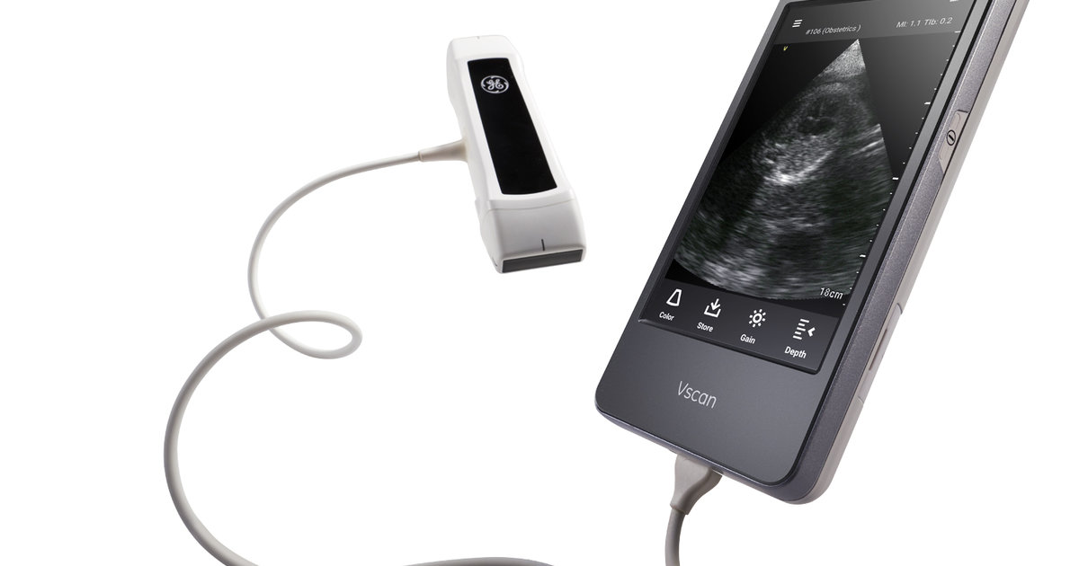 GE HealthCare adds AI guidance to handheld ultrasound devices