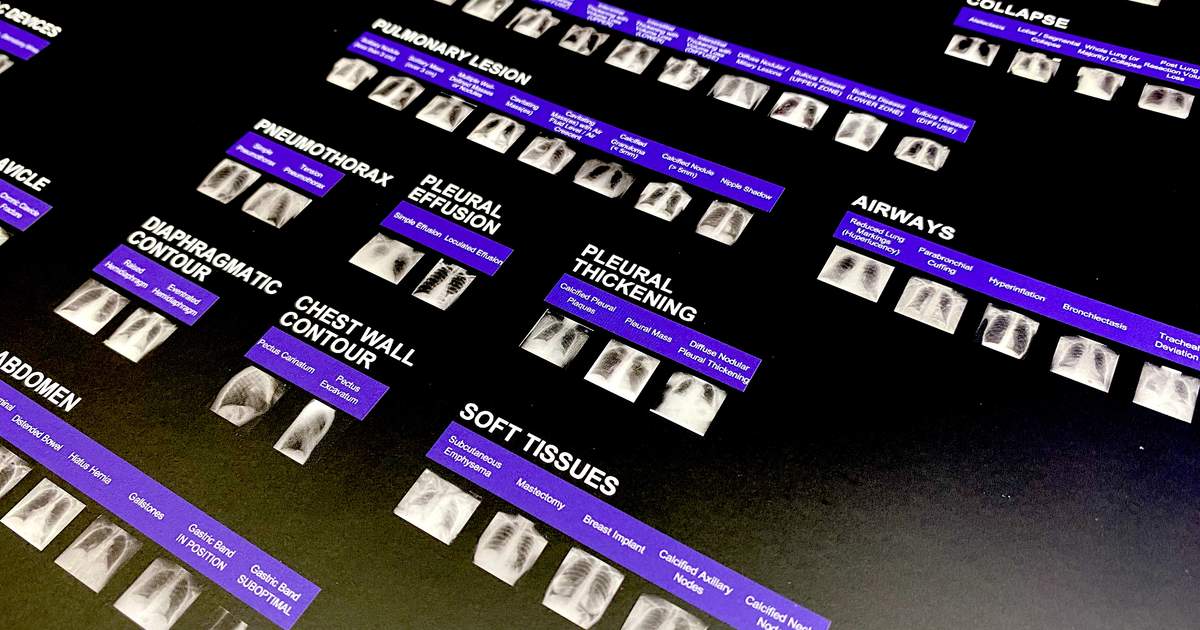 FDA has now cleared 700 AI healthcare algorithms, more than 76% in ...