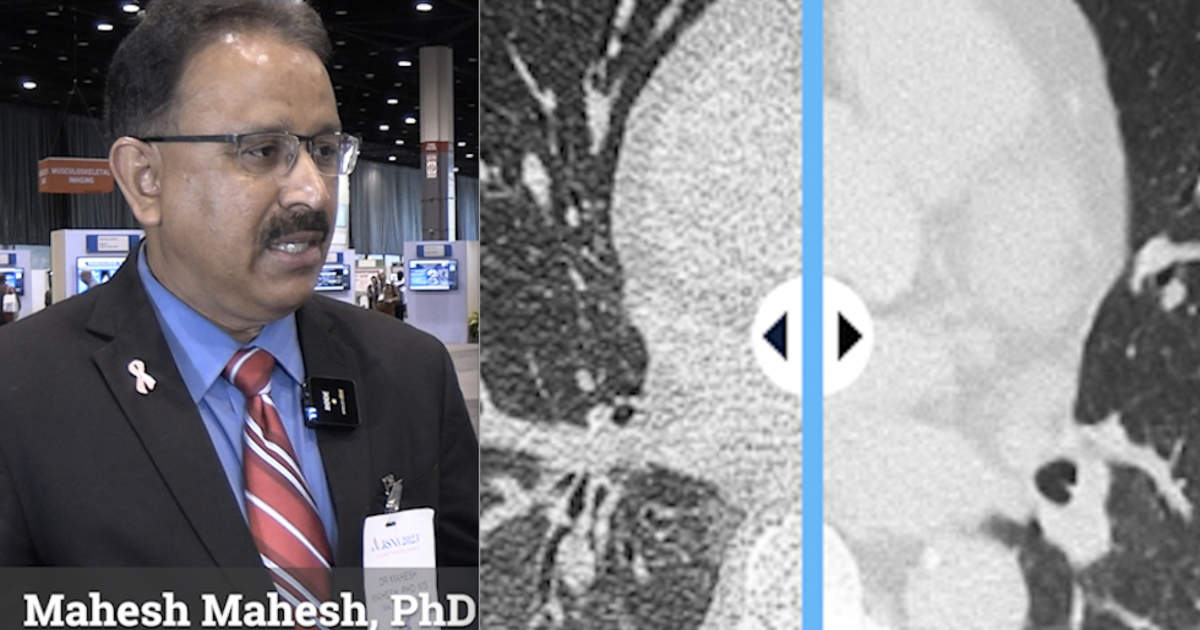 6 key trends in medical imaging physics