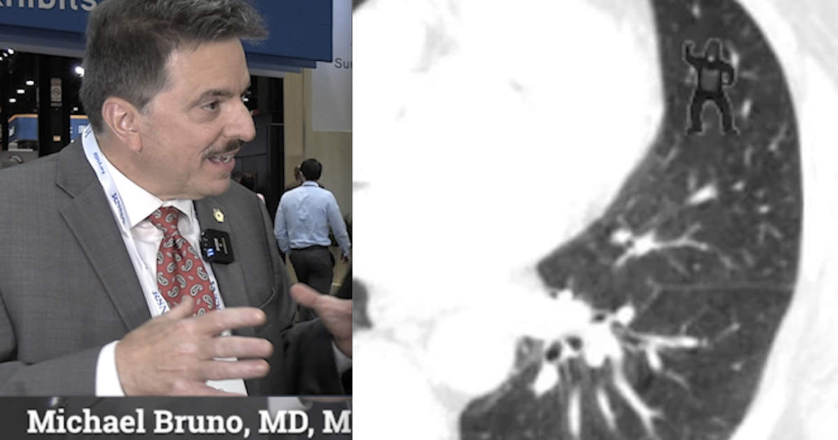 Error rates in radiology have not changed in 75 years