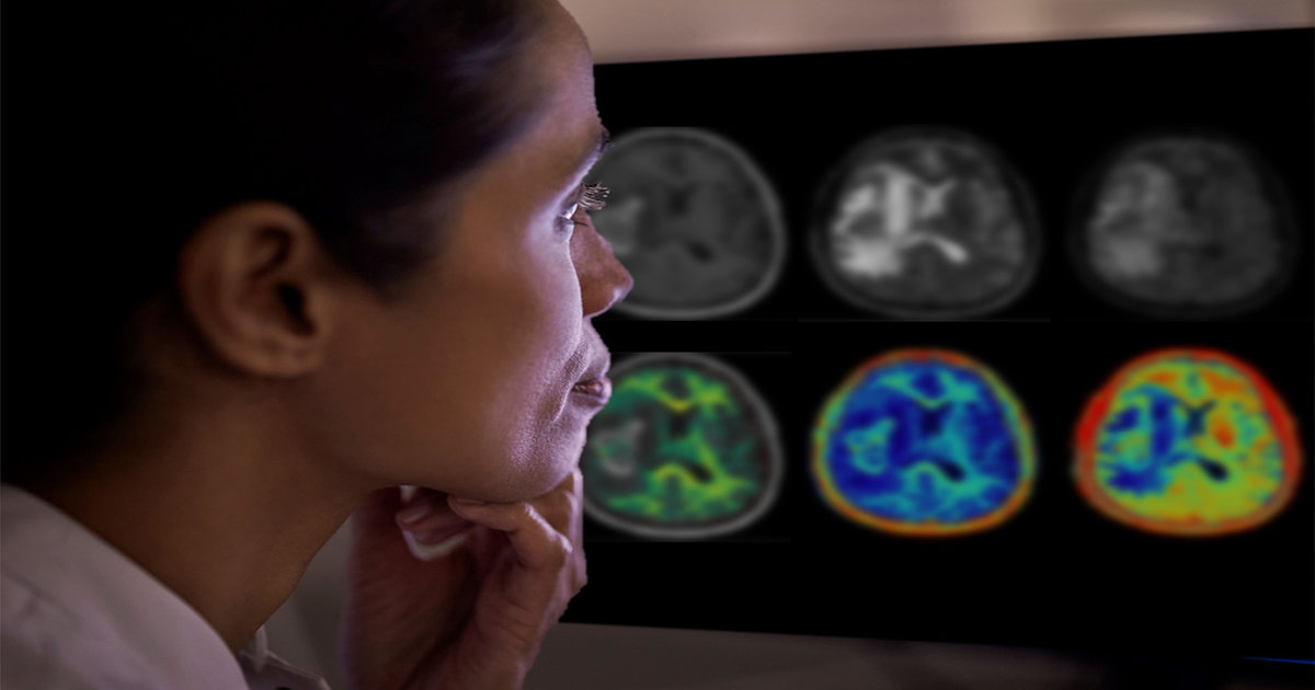 PHOTO GALLERY of brain imaging