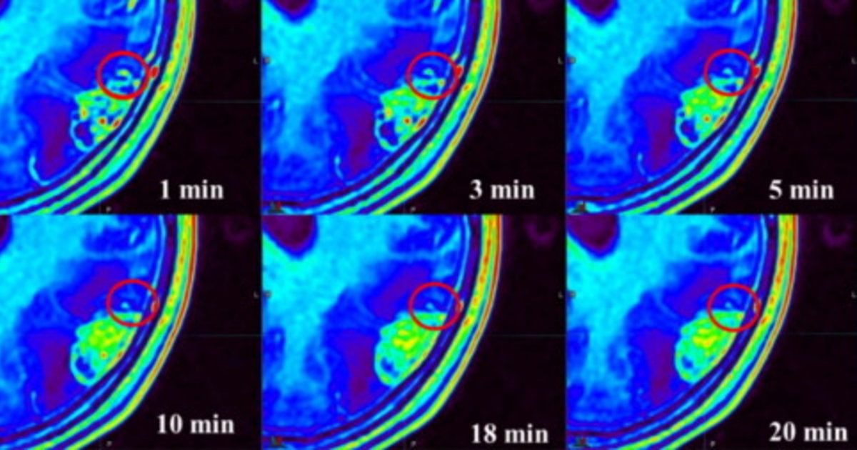Using multiple MRI phases after contrast injection significantly ...