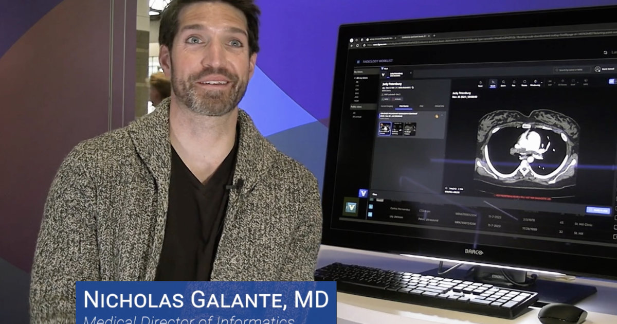 AI is revolutionizing radiology workflow and patient care