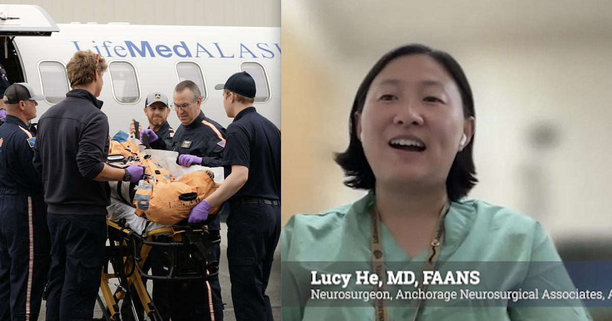 Revolutionizing stroke care in rural Alaska with AI and CT imaging