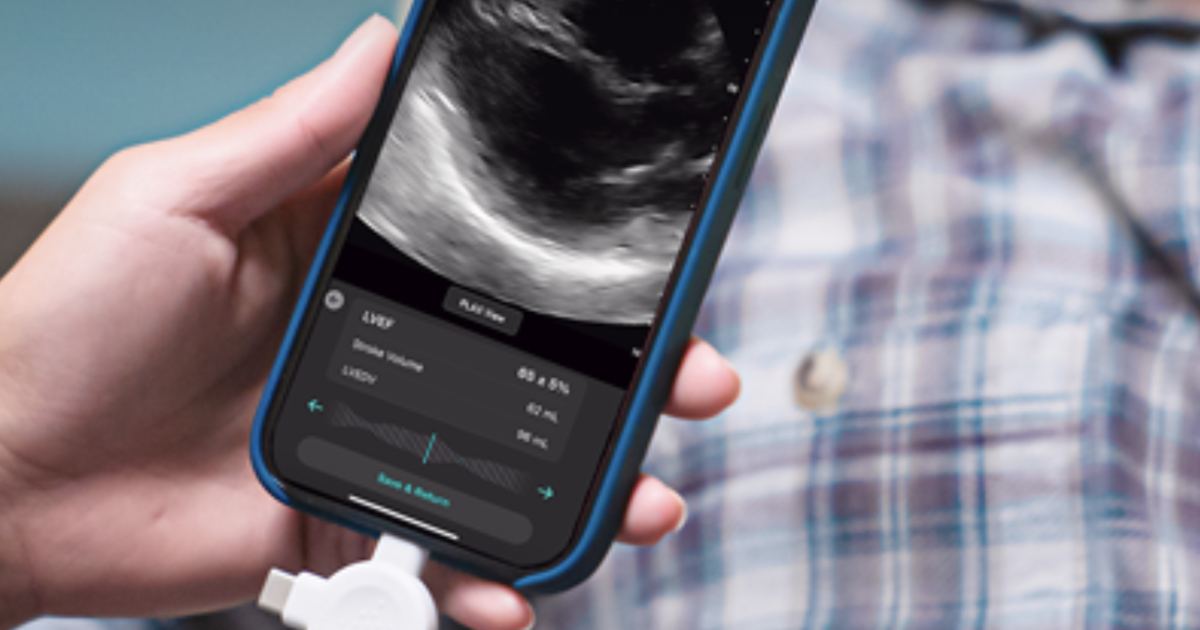 First AI-enabled POCUS app for detecting pleural effusion and atelectasis earns FDA clearance