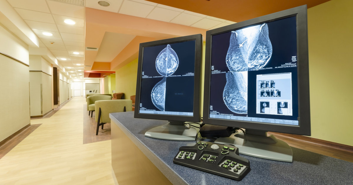 Rayus Radiology joins others in offering $40 mammography AI add-on service