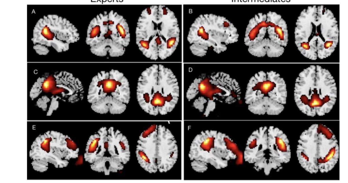 The brains of expert AI prompt engineers really are wired differently