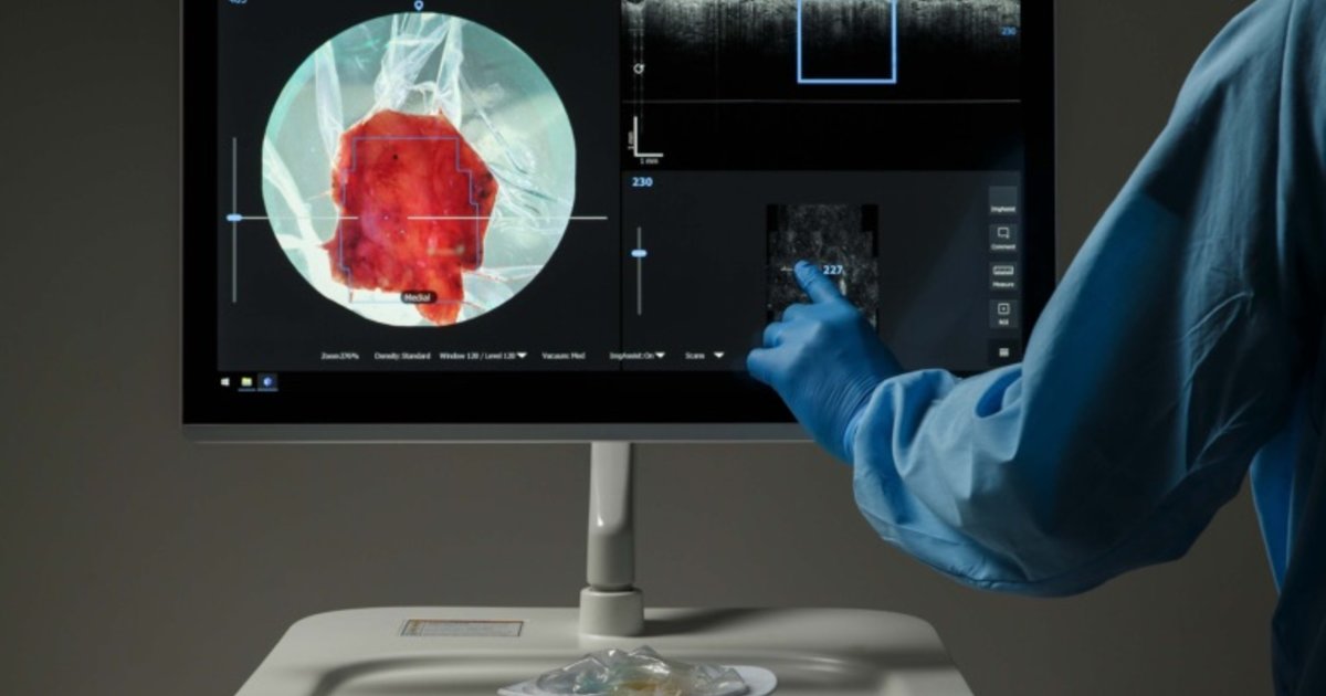 FDA approves 1st AI-enabled imaging device for breast cancer surgery
