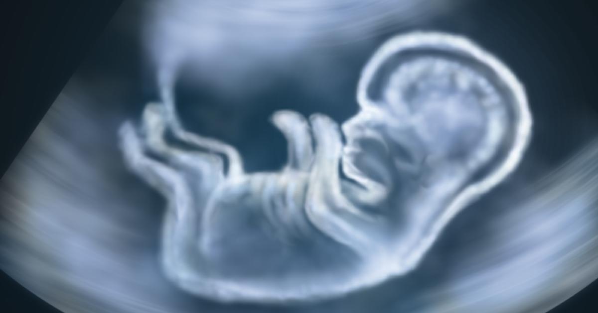 New criteria aims to improve diagnosis of nonviable pregnancies