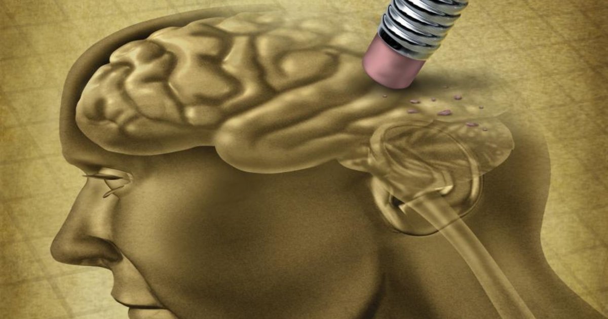 AAIC: F-18 Flute shown to change management in 20% of dementia patients