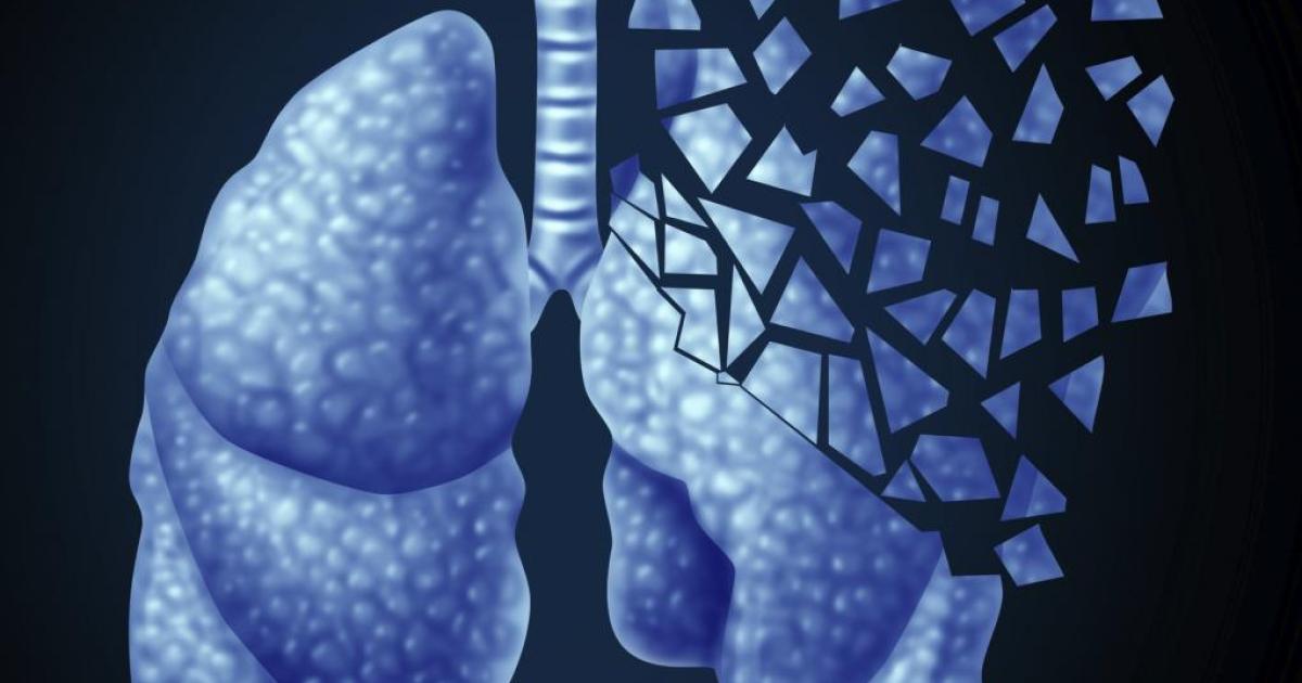 What NLST data tells us about Lung-RADS classifications