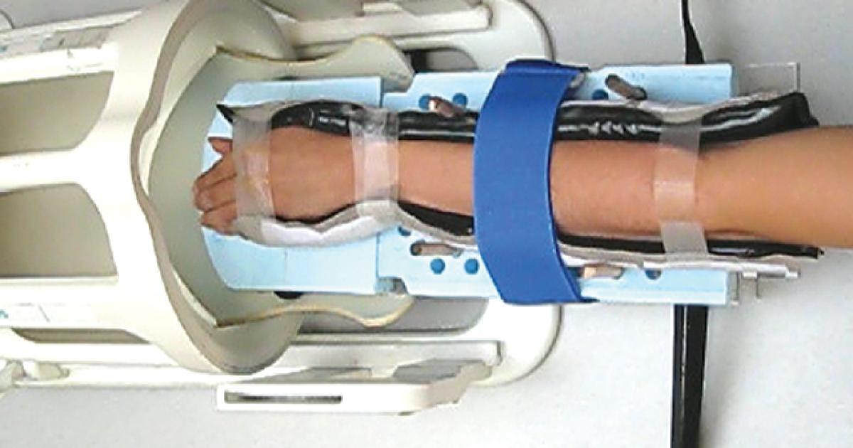 Musculoskeletal Imaging: Extremity Imaging Equipment