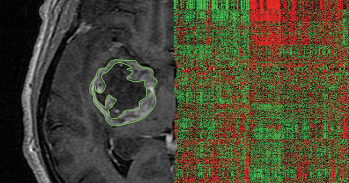 Imaging Genomics in the Age of Bioinformatics