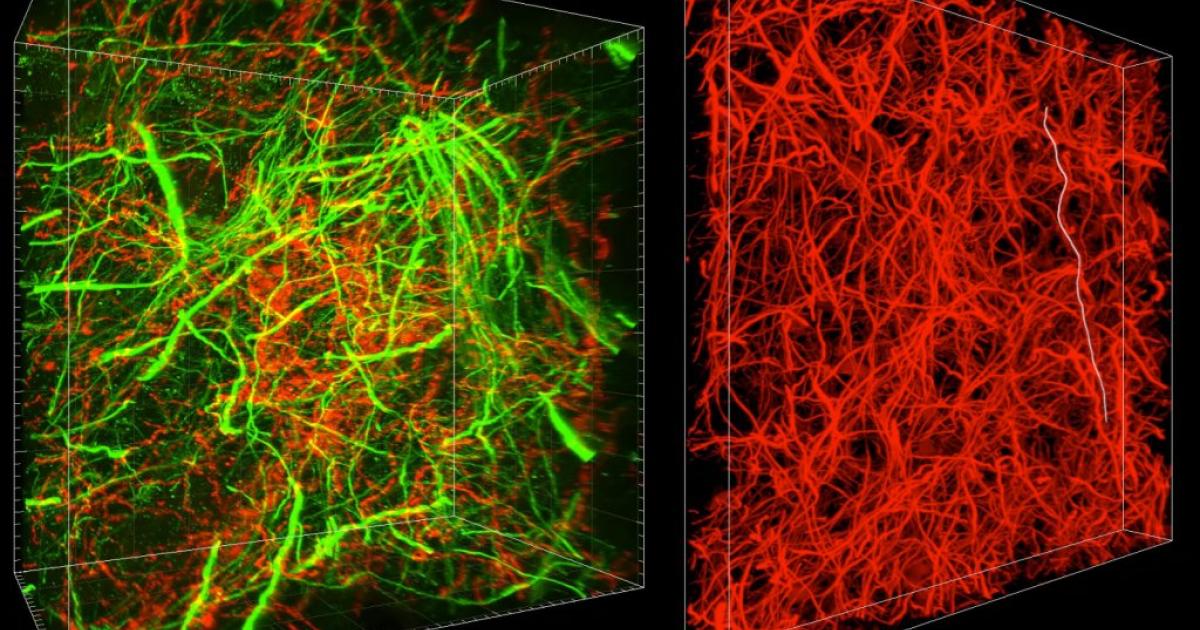 New technique allows for zooming in, out of brain imaging at different ...