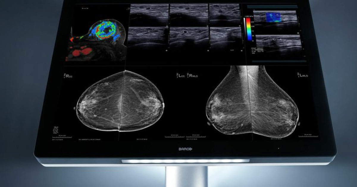 Barco’s new 12MP monitor not for mammograms only