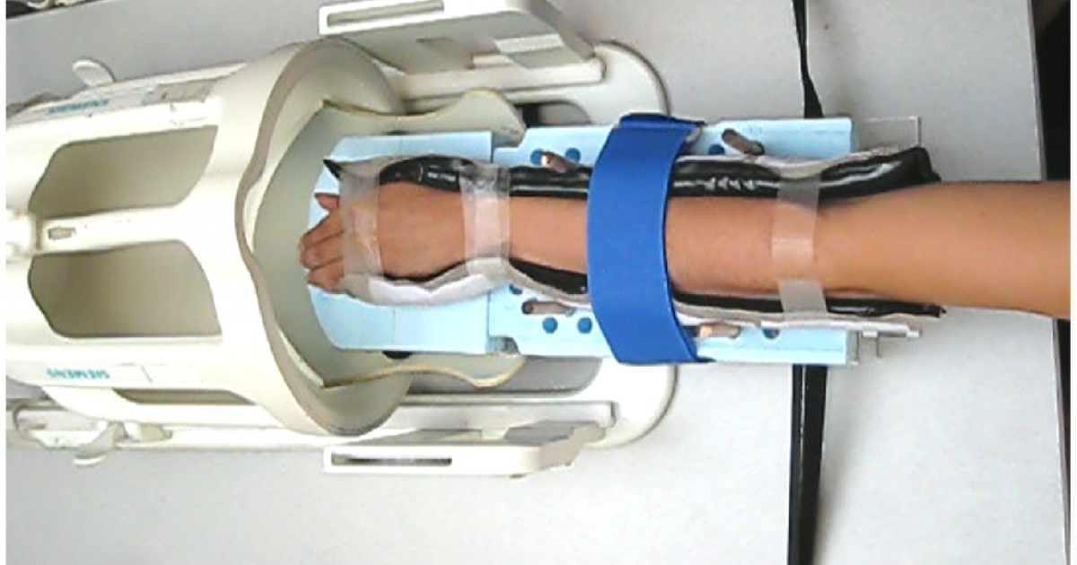 MRI technique allows study of wrist in motion