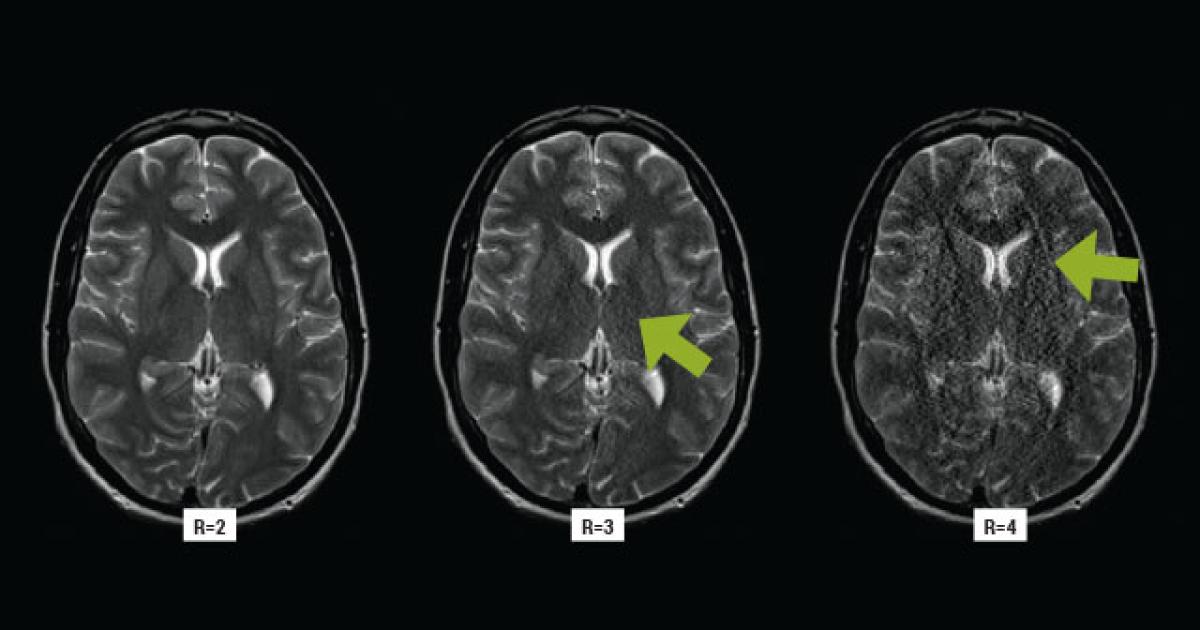 MRI’s Expanding Frontiers: Scanning More, Scanning Faster