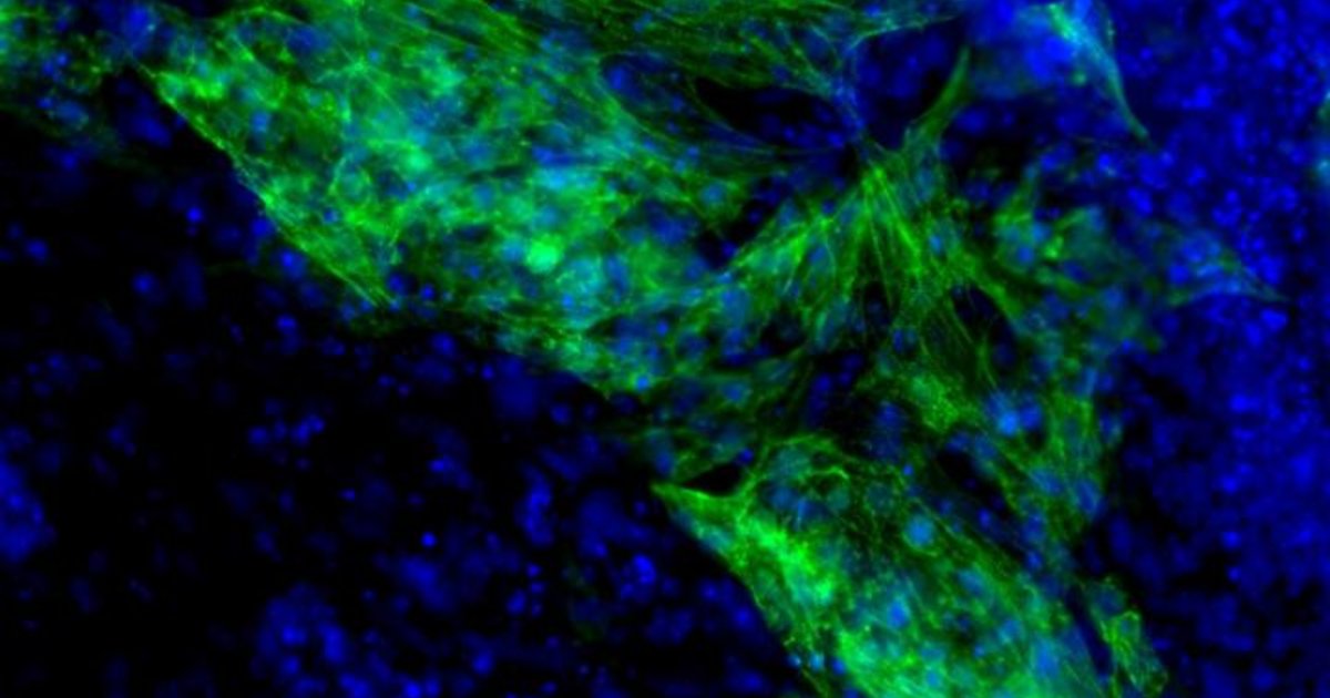 Human heart regeneration on the horizon