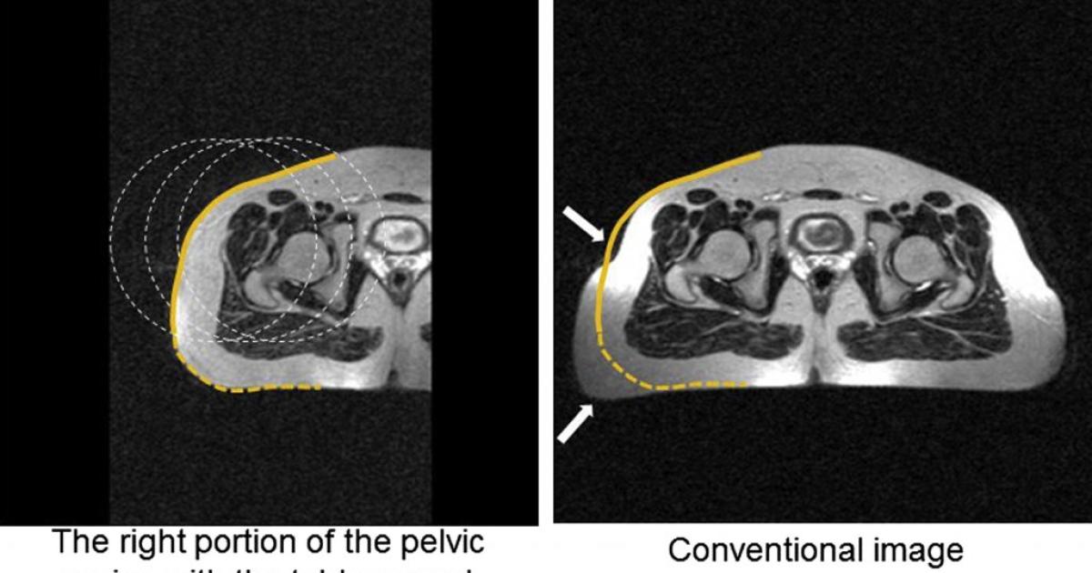Slide on over: Open MRI table movement improves off-center visualization