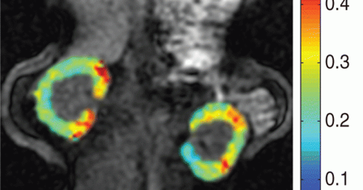 DCE MR imaging noninvasively evaluates renal function