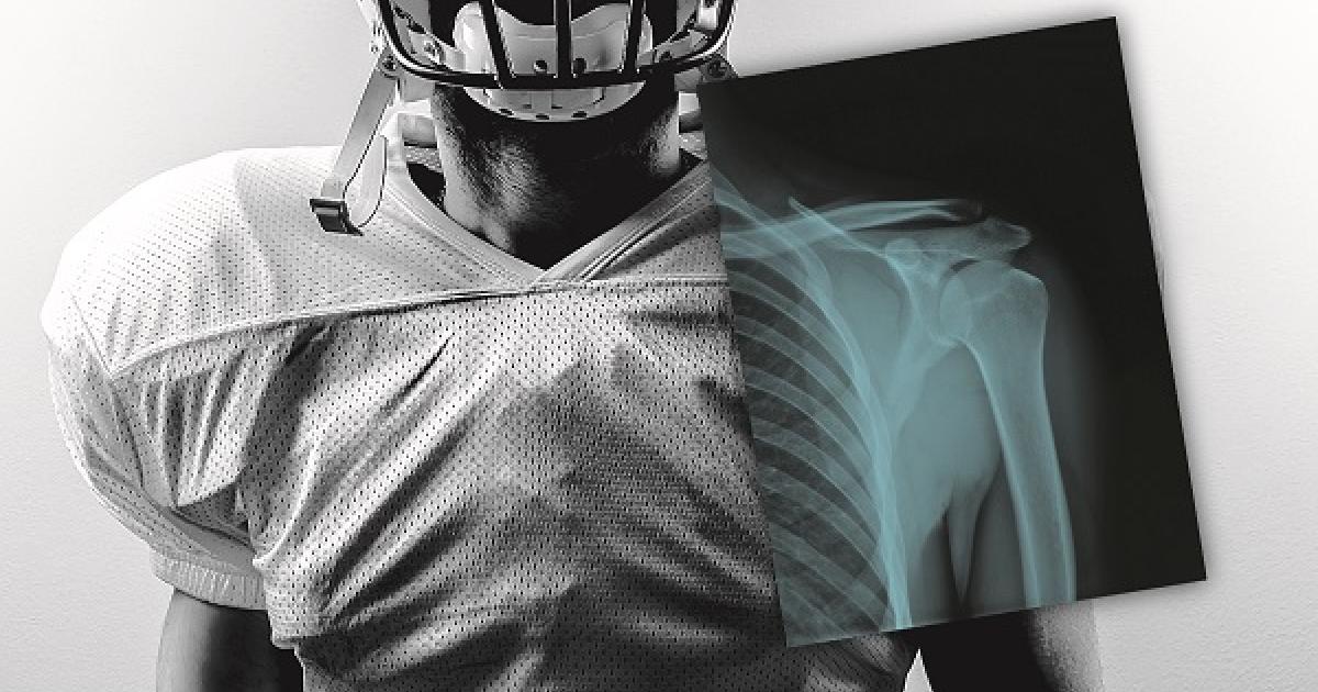 New Digital X-ray Technology Delivers Rapid Access to Diagnostic Images ...