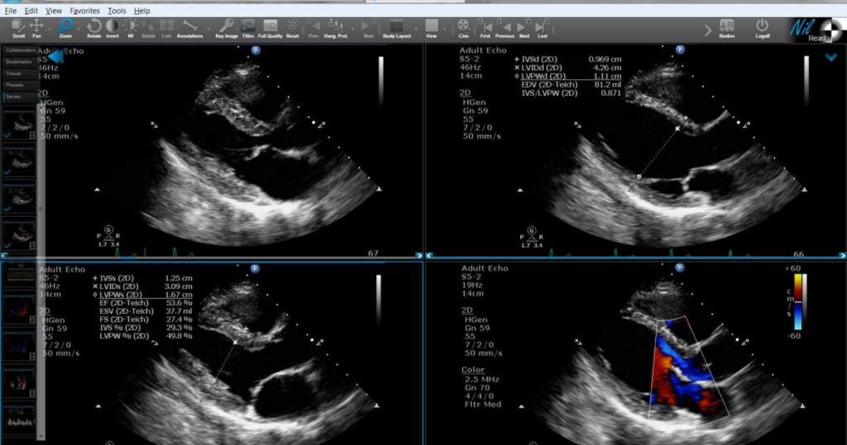 Claron Debuts Enhanced Modality Support for Nil Universal Viewers